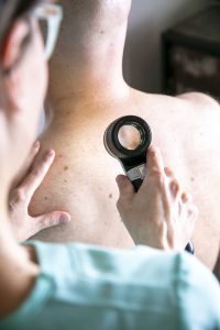 Visit our skin cancer clinic for a full skin cancer check